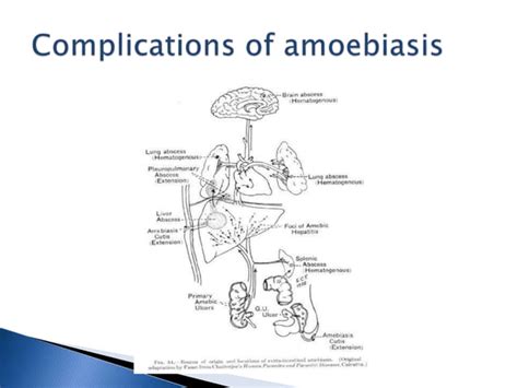 Amoebiasis Pathogenesis And Pathology Pptx Digestive Disorders Diseases And Conditions