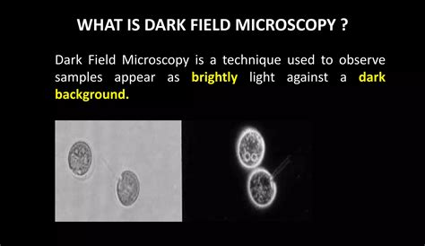 Dark Field And Phase Contrast Microscope Pptx