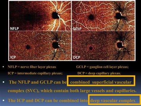 Prognostic Value Of Multiple Differential Diagnosis Of Onh By Oct Angio Pptx