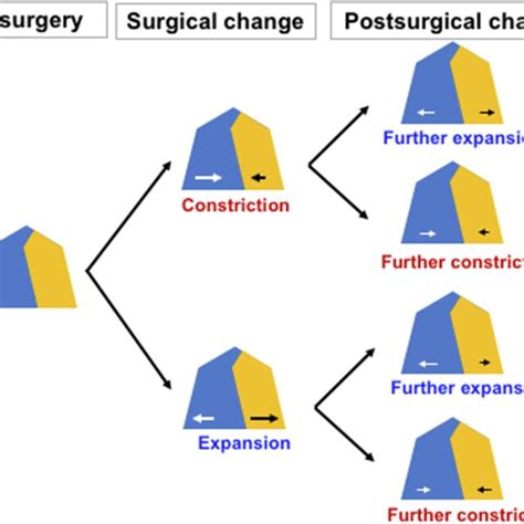 Veaus Cleft Lip Classification Download Scientific Diagram