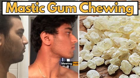 Fwhr How To Measure Calculate And Maximize Facial Ratios Mewinghub