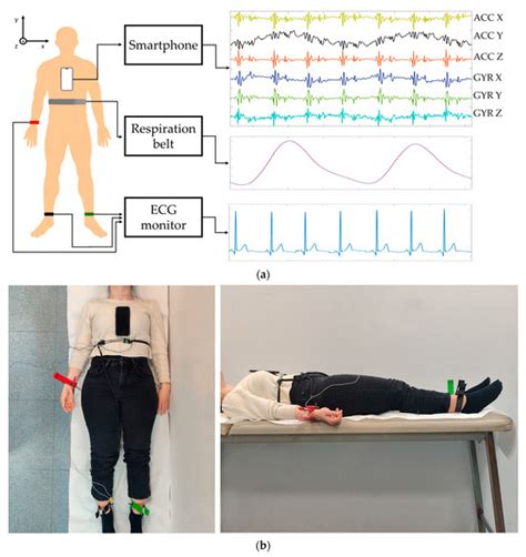 Accuracy Of The Instantaneous Breathing And Heart Rates Estimated By Smartphone Inertial Units