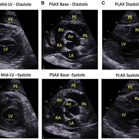 Pulsed Wave Pw Doppler Spectral Display And Echocardiographic