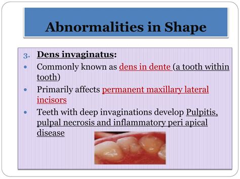 Ppt Disorders Of Development Of Teeth Powerpoint Presentation Free
