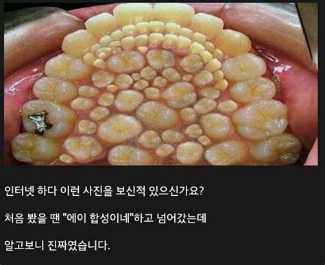 혐오주의 232개의 이빨을 가진 소년 미스터리공포 에펨코리아