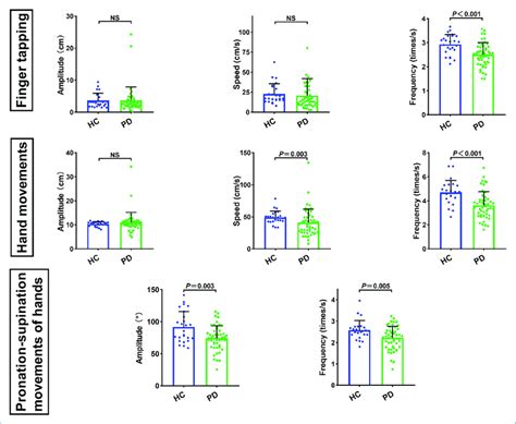 Comparison Of Kinematic Features Of Upper Limbs Movements Between Pd Download Scientific