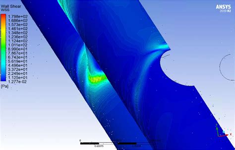 Figure 18 From Computational Fluid Dynamics Modeling Of Hemodialysis In Computational Fluid