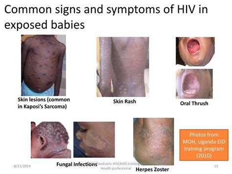 Ppt Module Ii Diagnosing Paediatric Hiv Powerpoint Presentation
