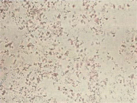 无定形磷酸盐结晶 实验诊断学