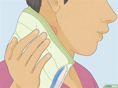 How To Reduce Lymph Node Swelling Best Methods How To Reduce Lymph Node Swelling Best Methods