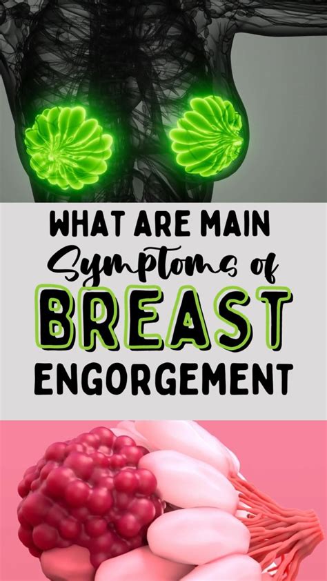 What Are Breast Engorgement Symptoms And Relief Tips Artofit