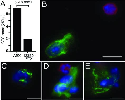Ctc Evaluation Using An Orthotopic Breast Cancer Mouse Metastatic Download Scientific Diagram
