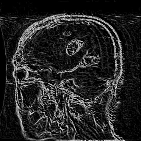 Mri Object Detection Dataset By Brain Mri