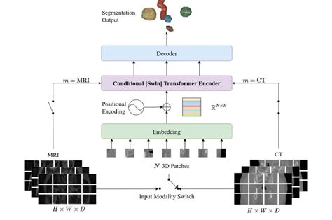 Segmentation Of Knee Bones For Surgical Planning Mines Paris Research