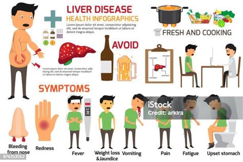 간 질병 벡터 인포 그래픽입니다 기호와 간 질환의 증상입니다 벡터 일러스트 레이 션 간염에 대한 스톡 벡터 아트 및 기타 이미지 간염 감압병 건강관리와 의술 Istock