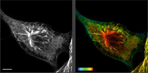 What Is Flim Fluorescence Lifetime Imaging Microscopy Learn And Share Leica Microsystems