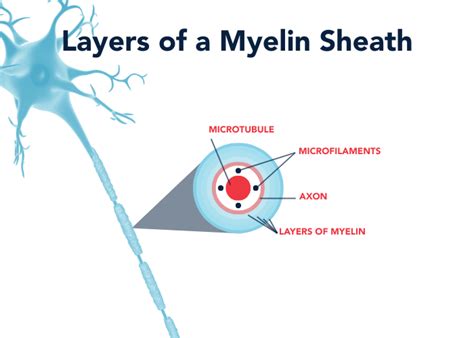 The Process Of Demyelination American Brain Foundation