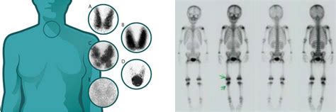 Uses Of Technetium M Radioactive Isotopes