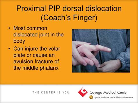 Ppt Common Hand And Wrist Injuries Powerpoint Presentation Free