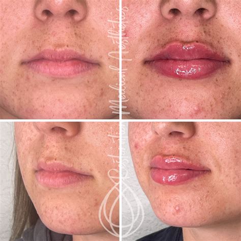 Restoration Medical Aesthetics Services At Zane Hodge Blog