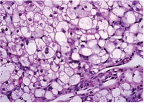 Hepatic Lipidosis Clinical Review Drawn From Collective Effort Craig