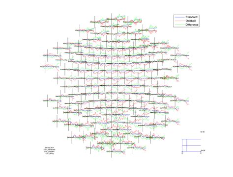 Preprocessing And Event Related Activity In Combined Megeeg Data