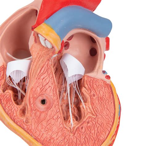 Anatomical Heart Model Anatomy Of The Heart Left Ventricular Lvh Heart Model