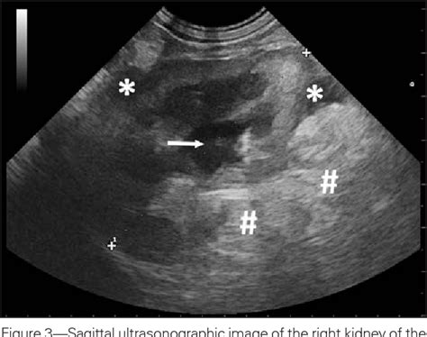 Figure 3 From What Is Your Diagnosis Pyonephritis Semantic Scholar