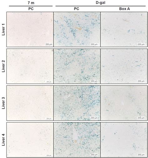 The Roles Of Hmgb1‐produced Dna Gaps In Dna Protection And Aging Biomarker Reversal Pmc