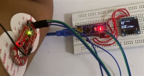 Electromyography With Myoware Muscle Sensor And Arduino