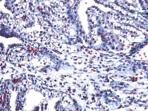 Choroid Plexus Stage Ii With Loose Stroma Trichromic Gs Staining ×