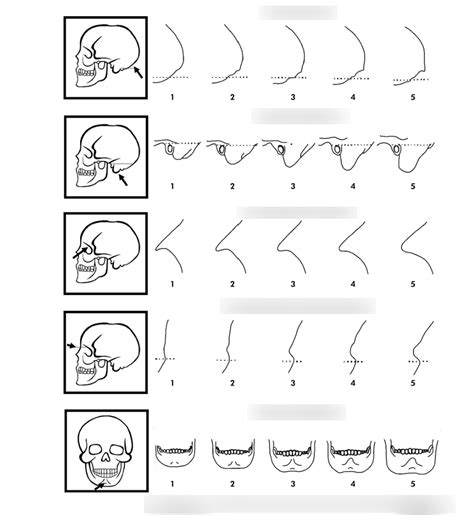 Sex Determination In Skull Diagram Quizlet