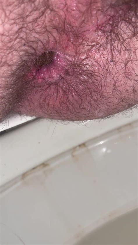 Hard Hairy Hole Stretcher
