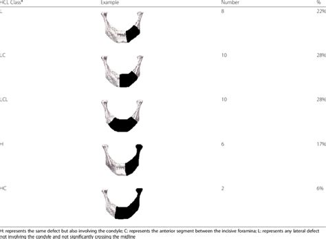 Characterization Of The Bony Defect As Per Hcl Classification