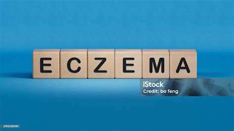 나무 블록은 습진이라는 단어를 형성합니다 의학 개념 병원 클리닉 및 의료 비즈니스를 위한 의료 개념 파란색 배경에 렌더링하는 비즈니스 Concept3d 0명에 대한 스톡