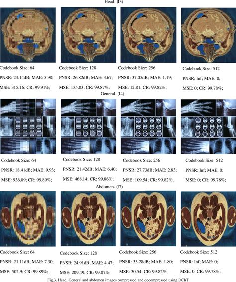 figure 3 from a machine learning algorithm for biomedical images