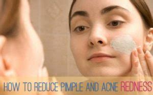 How To Reduce Pimple Size Reduce The Size Of A Pimple