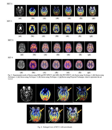 Github Mayukhmalajanafusion Of Multimodal Images Using Parametrically Optimized Pcnn And Dct