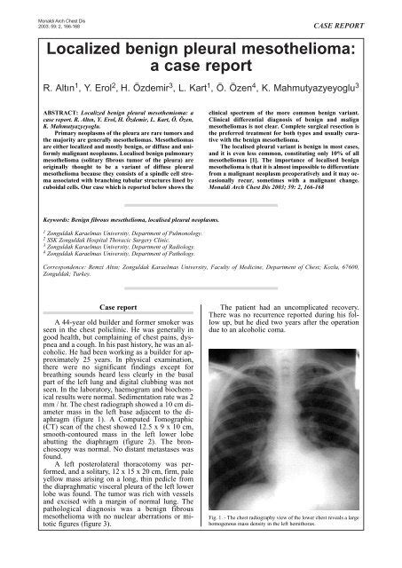 Localized Benign Pleural Mesothelioma