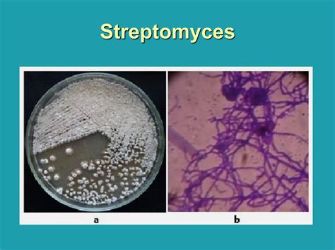 Gram Positive Bacilli Morphology And Classification Pdf