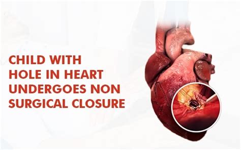 Heart In The Hole What Are The Symptoms Of A Hole In The Heart Hysk