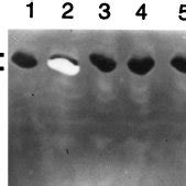 Pectinase Activities In Culture Filtrates Of Transformants Grown In
