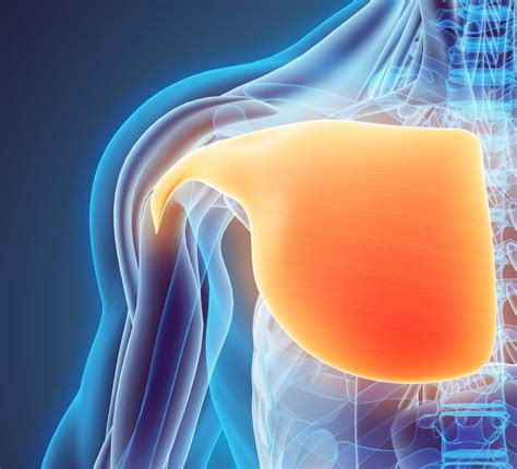 Pectoral Tear Shoulder Specialist Van Nuys Westlake Village Los