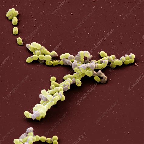 Streptococcus Pneumoniae Bacteria Sem Stock Image B2360141 Science Photo Library
