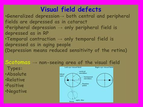 Visual Field Analysis Interpretation Pptx Eye And Vision Conditions Diseases And Conditions