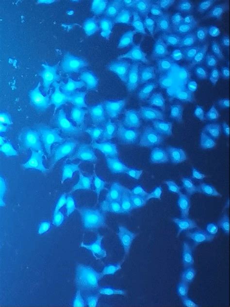 Wayne Forday On Linkedin Hela Cells After Dapi Staining For Detectint Mycoplasma Contamination