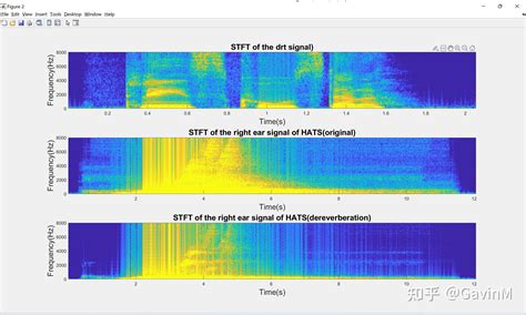 Binaural Speech Dereverberation(双耳语音去混响算法实验) 知乎 Binaural Speech Dereverberation(双耳语音去混响算法实验) 知乎