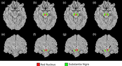 Examples Of Typical Mislabeling And Underlabeling Errors On A Download Scientific Diagram