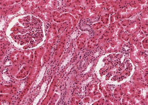 Juxtaglomerular Cells Histology