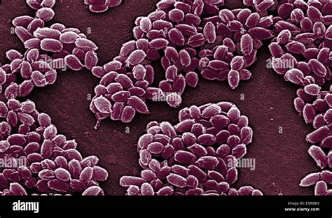 Bacillus Atrophaeus